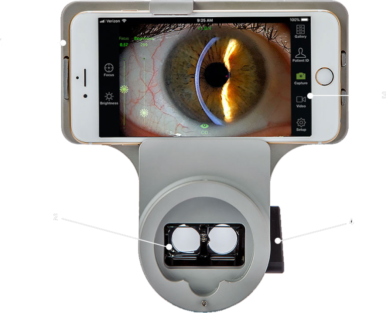 Marco iON Imaging System - Gold Coast Ophthalmic Instruments, Inc.