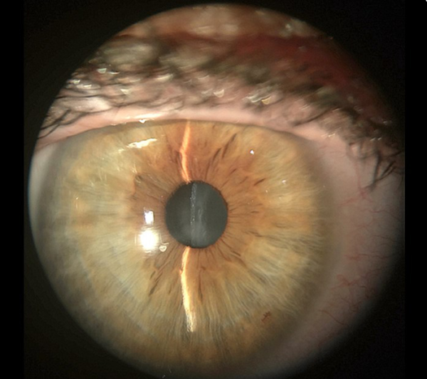 Marco iON Imaging System - Gold Coast Ophthalmic Instruments, Inc.