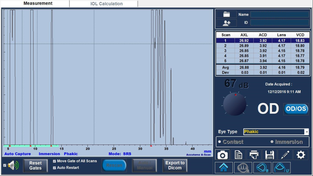 Keeler Accutome A-Scan Plus Connect - Gold Coast Ophthalmic Instruments ...