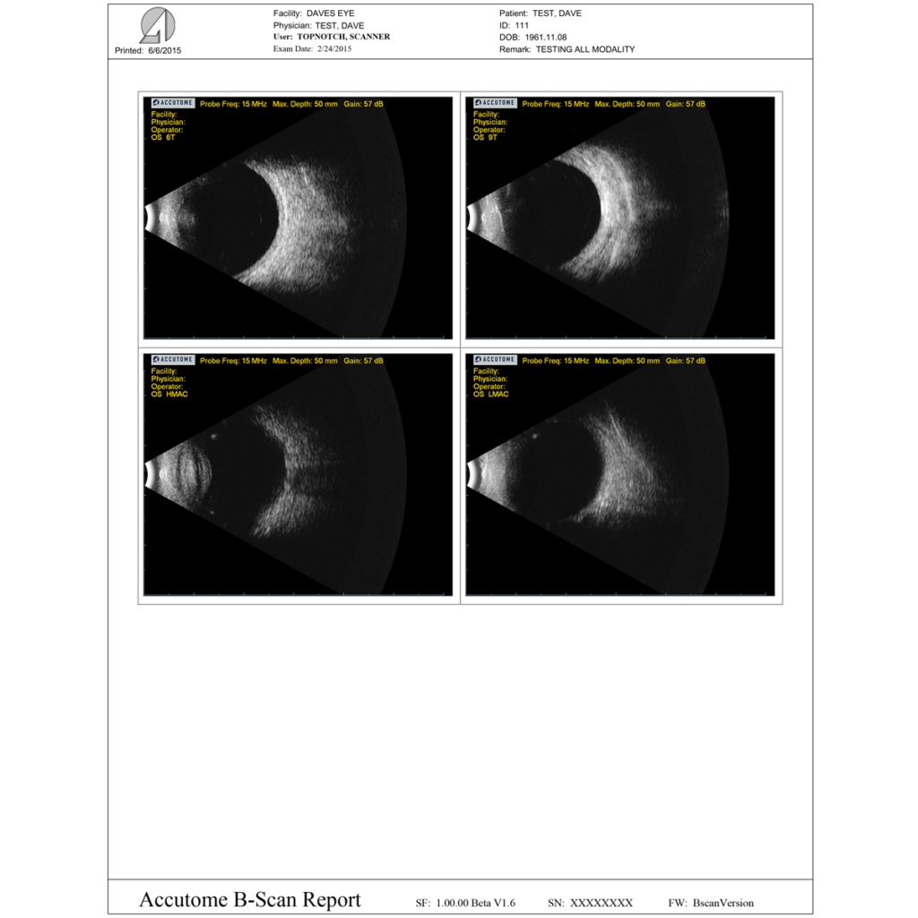 Keeler Accutome B-Scan Plus - Gold Coast Ophthalmic Instruments, Inc.