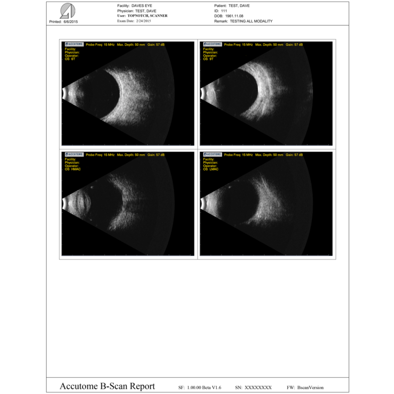 Keeler Accutome B-Scan Plus - Gold Coast Ophthalmic Instruments, Inc.